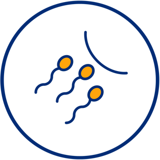 Can Testosterone Replacement Therapy (TRT) Cause Infertility?