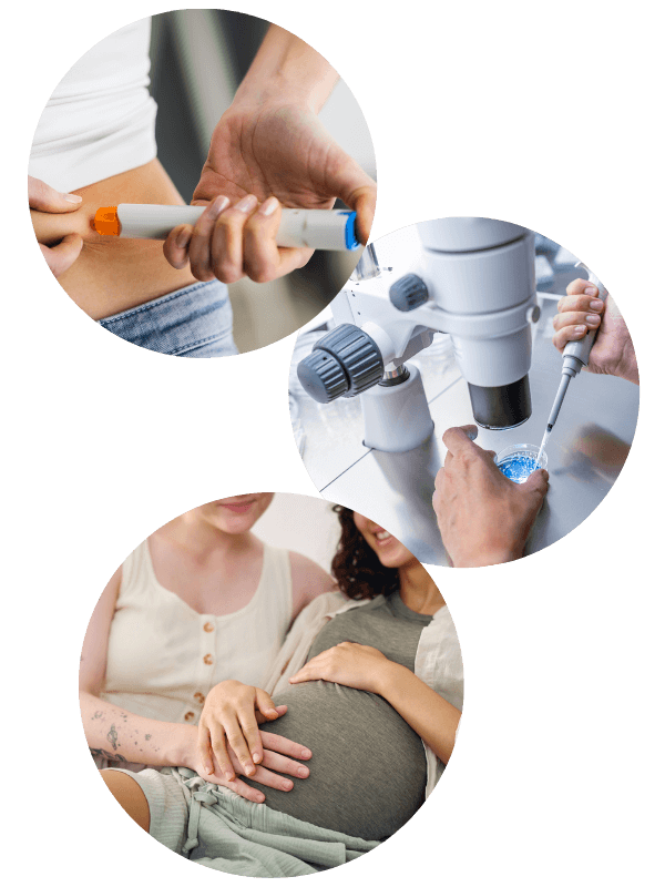 Reciprocal IVF Treatment | Illume Fertility